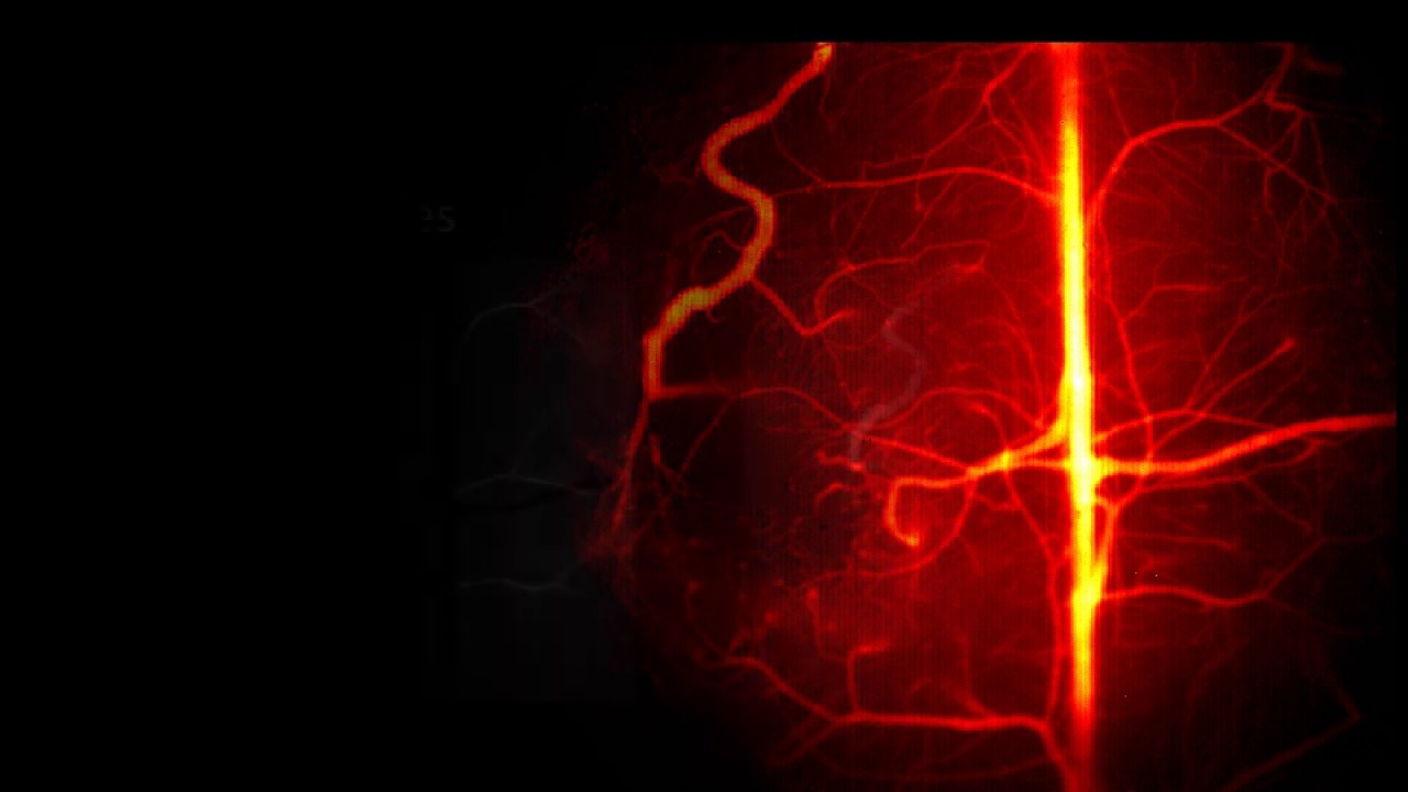 Intravital Imaging of Brain Vasculature using Shortwave Infrared ...