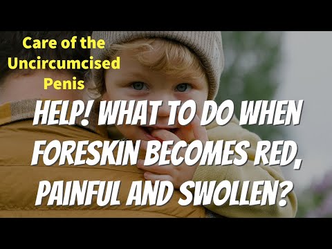 WHAT SHOULD PARENTS DO WHEN THE FORESKIN BECOMES RED, PAINFUL, AND SWOLLEN?
