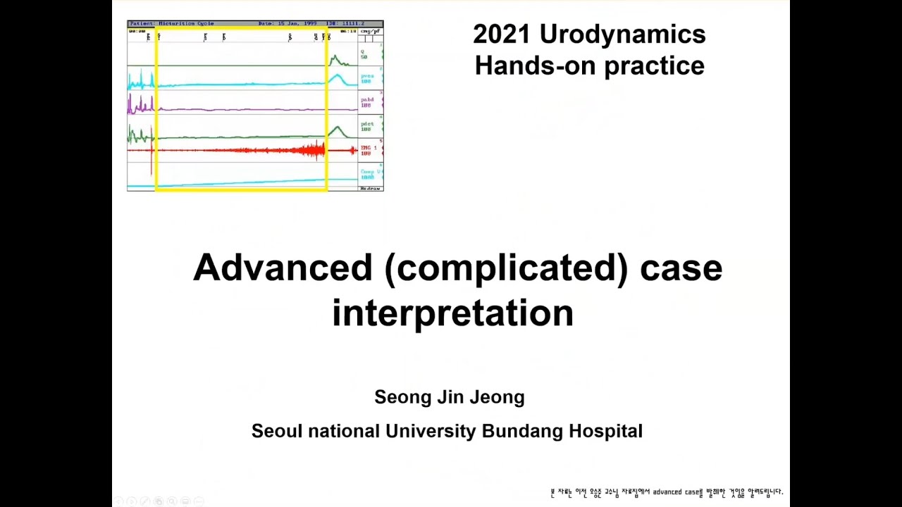 07 Advanced complicated case interpretation 서울의대 정성진 교수 - YouTube