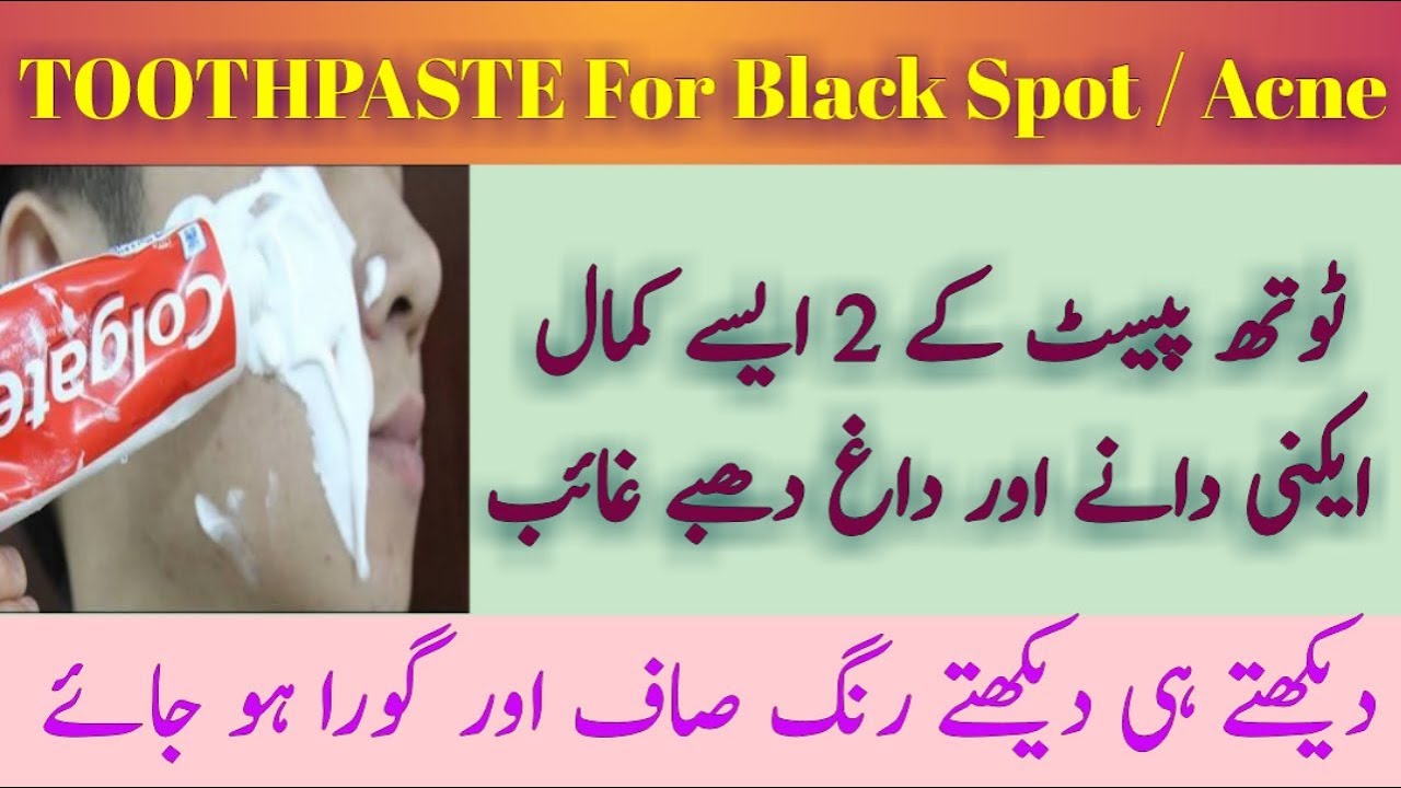 2 Magical Toothpaste Beauty Hacks | How to Get Rid Black spots Acne by ...