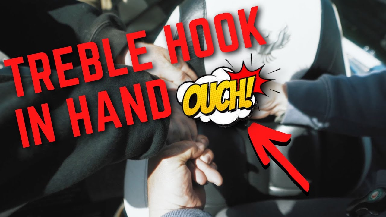 Ripped a Treble Hook Right Out! Removing Hook From Hand - YouTube