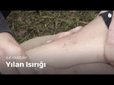 İlk yardım hareketlerini öğrenin: Yılan Isırığı
