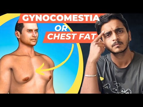 Gynecomastia Symptoms and Treatment | Gynecomastia V/S Chest Fat | Gyno ...
