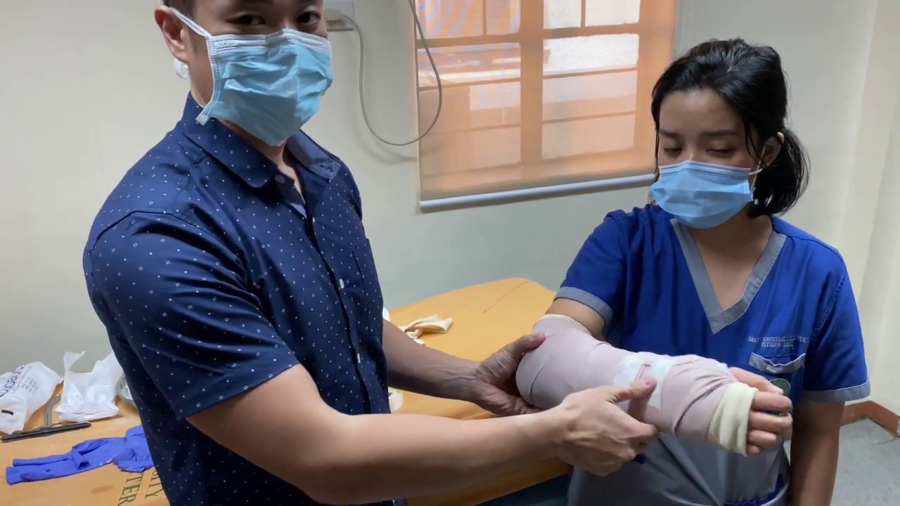 Coaptation Splint or U-Mold for forearm and wrist fractures - YouTube