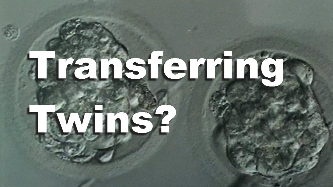 Transferring Two Embryos FET (Whole Procedure) - Wheeler IVF Journey ...