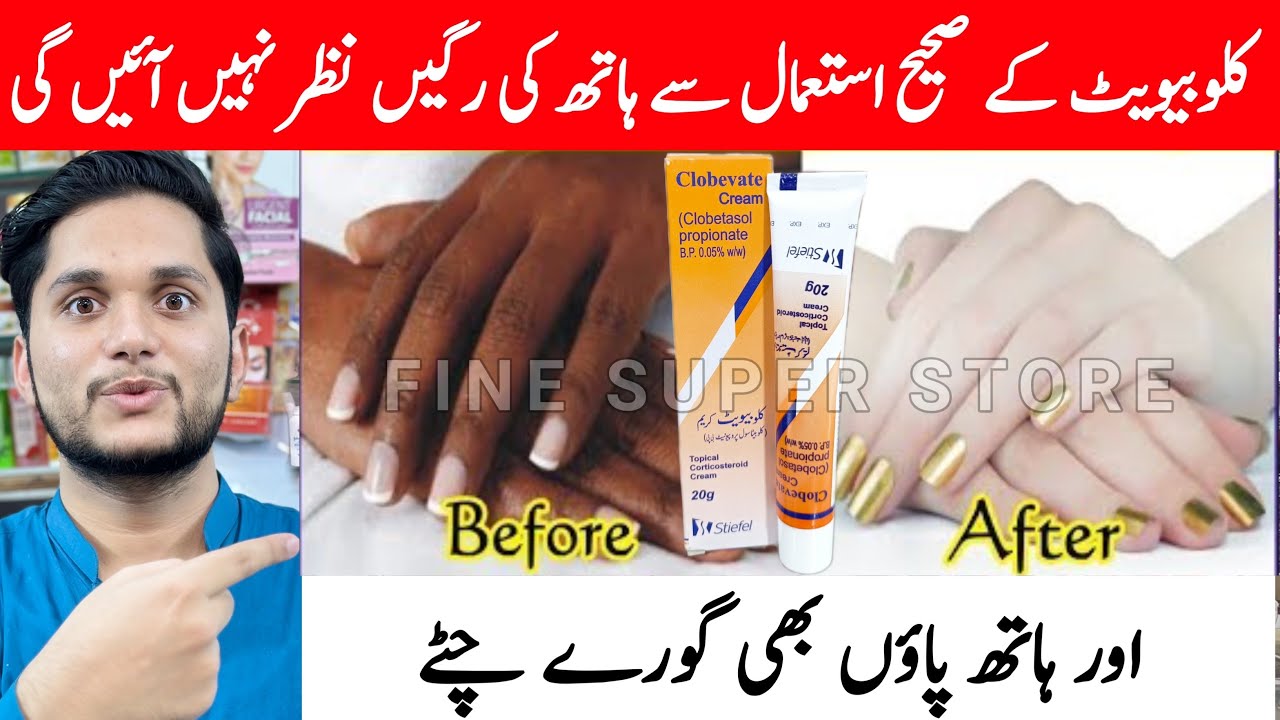 Clobevate farmula cream for hands and feet whitening with whitening ...