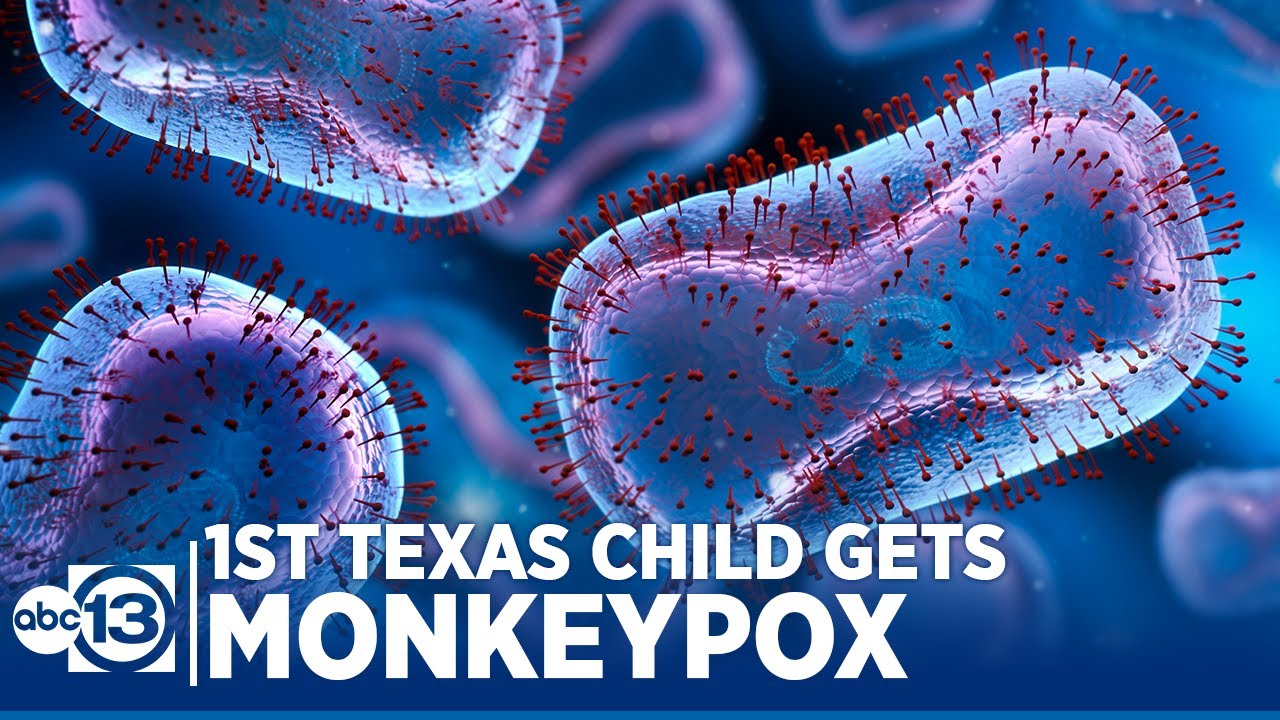 Harris Co 2 year old Has presumed Positive Monkeypox Case YouTube harris-co-2-year-old-has-presumed-positive-monkeypox-case-youtube