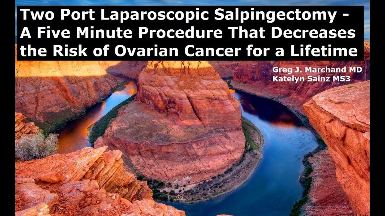 Two Port Laparoscopic Salpingectomy A Five Minute Procedure That ...
