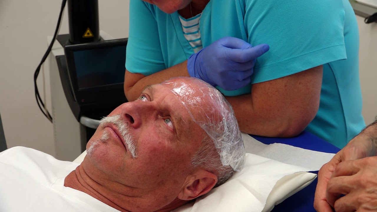 Indoor Daylight PDT - Behandlung mit der MultiLite - YouTube