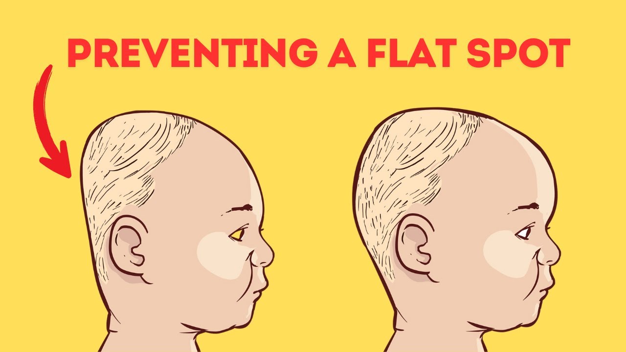 Best Way to AVOID a Flat Spot on Your Baby's Head - YouTube