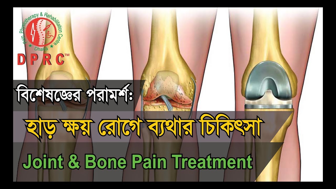 হাড় ক্ষয় রোগের চিকিৎসা ও পুনর্বাসন। Joint & Bone Pain treatment |Dr.Md.Shafiullah Prodhan ...