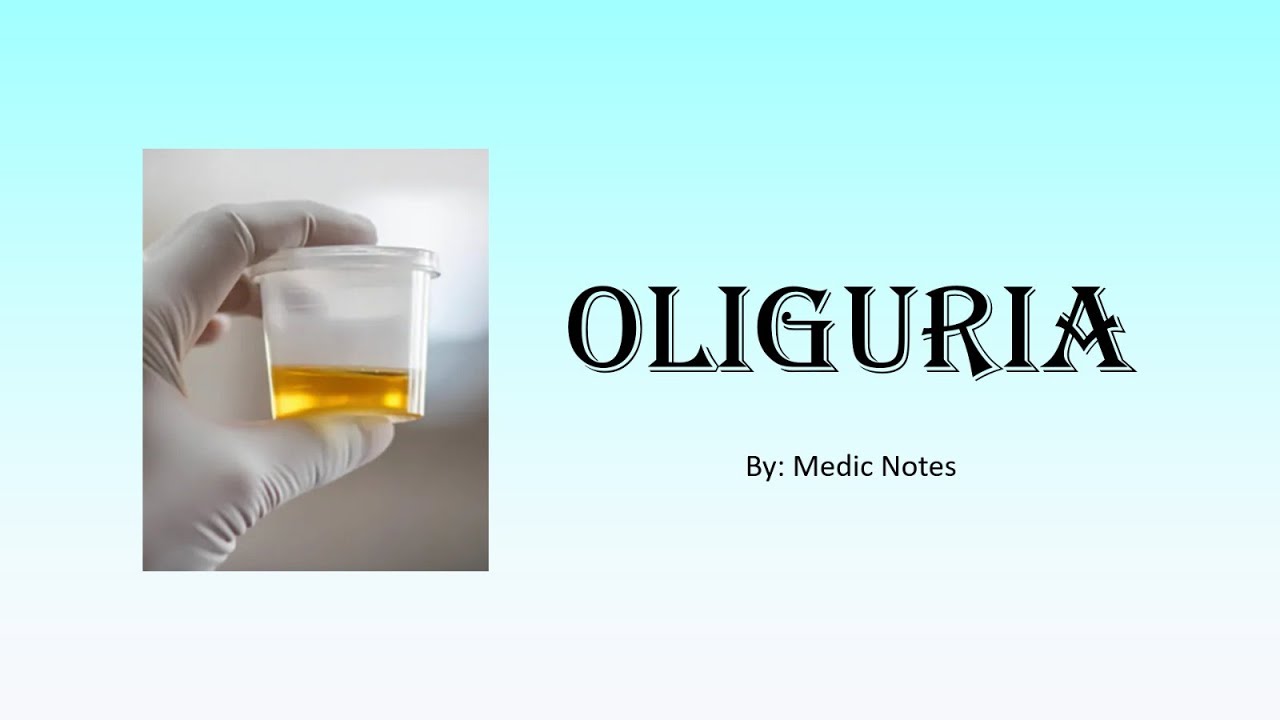 Oliguria causes and pathophysiology (pre-renal, renal, post-renal ...