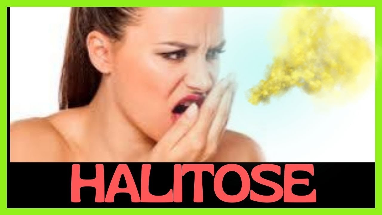 Halitose (Causas e Prevenção) - YouTube