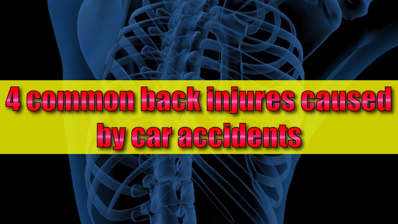 Back Injury: Common types of back injuries we see after a car accident ...