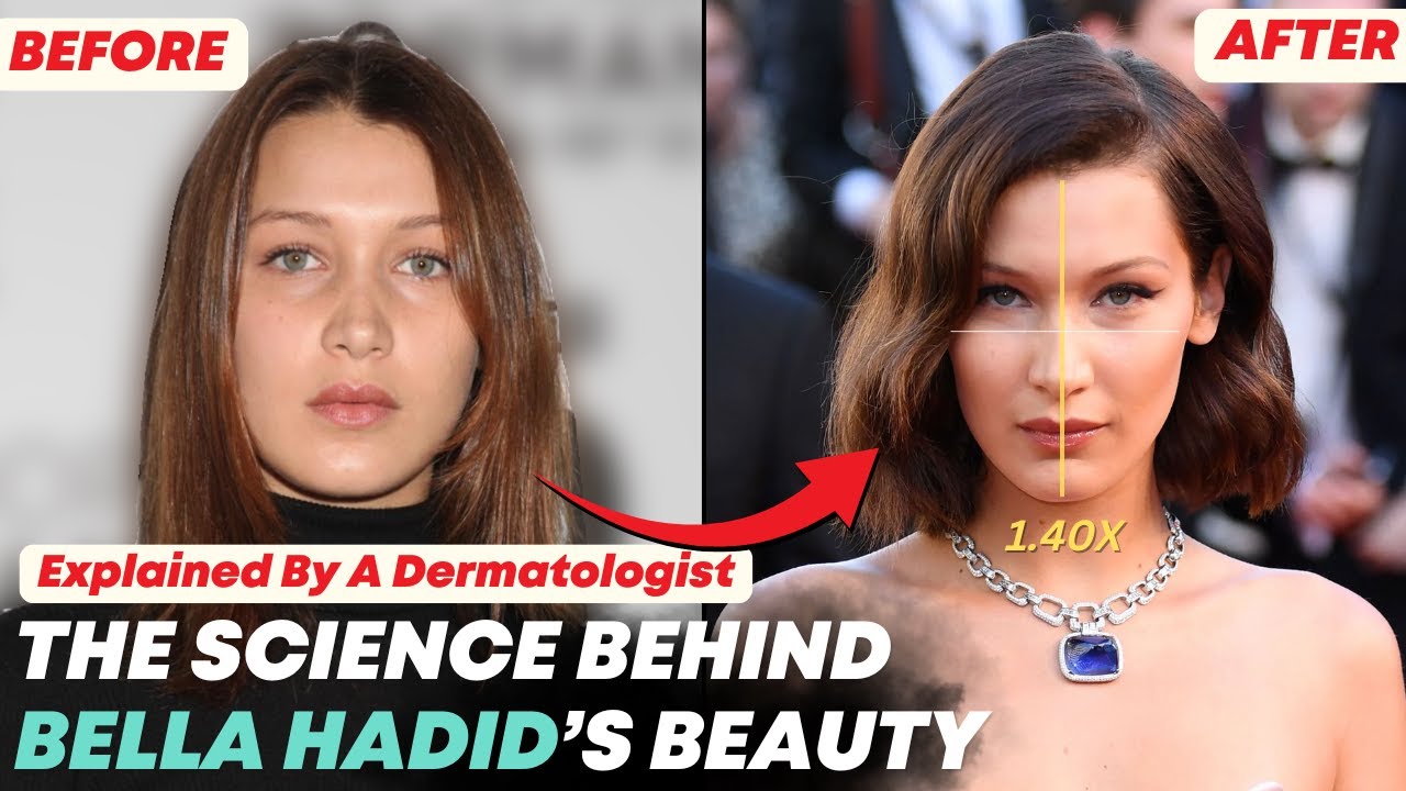 Science Behind Bella Hadid’s Beauty Explained By Dermatologist | Get ...