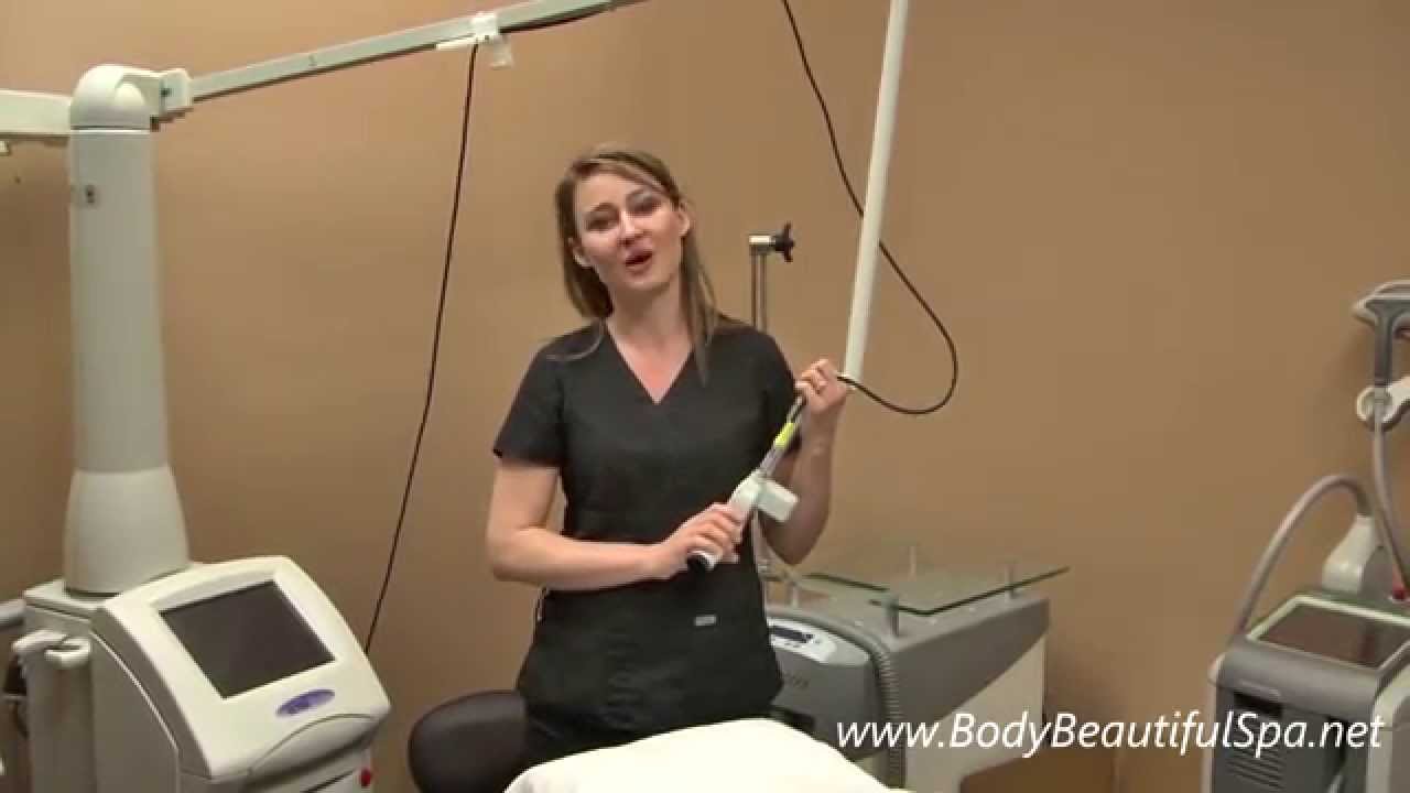 Active FX Co2 Laser - YouTube