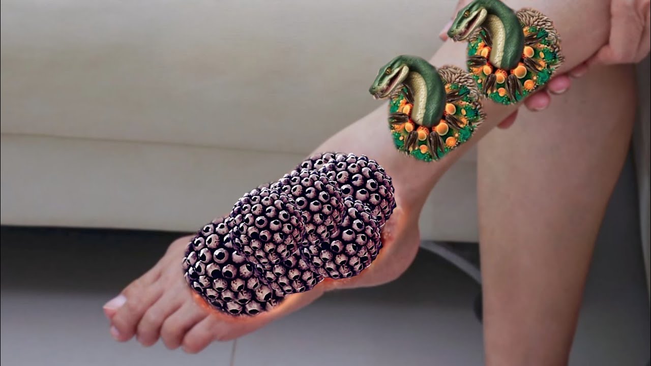 asmr animation video girl treatment | severely loosing leg treatment ...