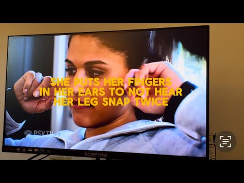 Watching a Woman in a Long Leg Cast Hear Her Bones Snapping While In a ...