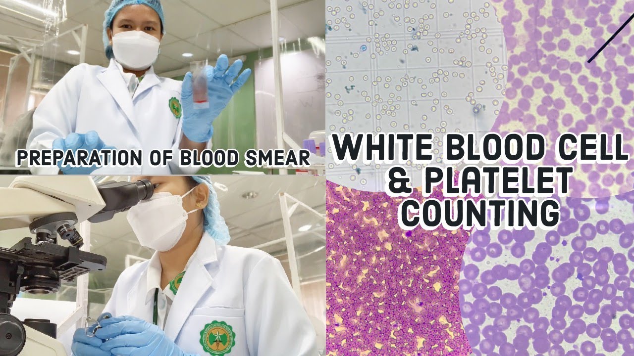 how to do blood smears and platelet counting (MedTech DLSMHSI ...