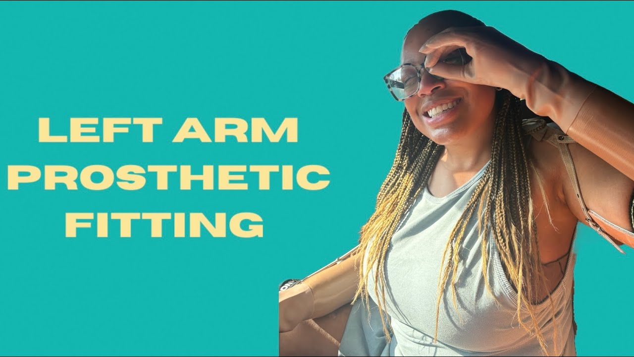 Getting My Left Arm Prosthetic | Part 1: The Casting Process - YouTube
