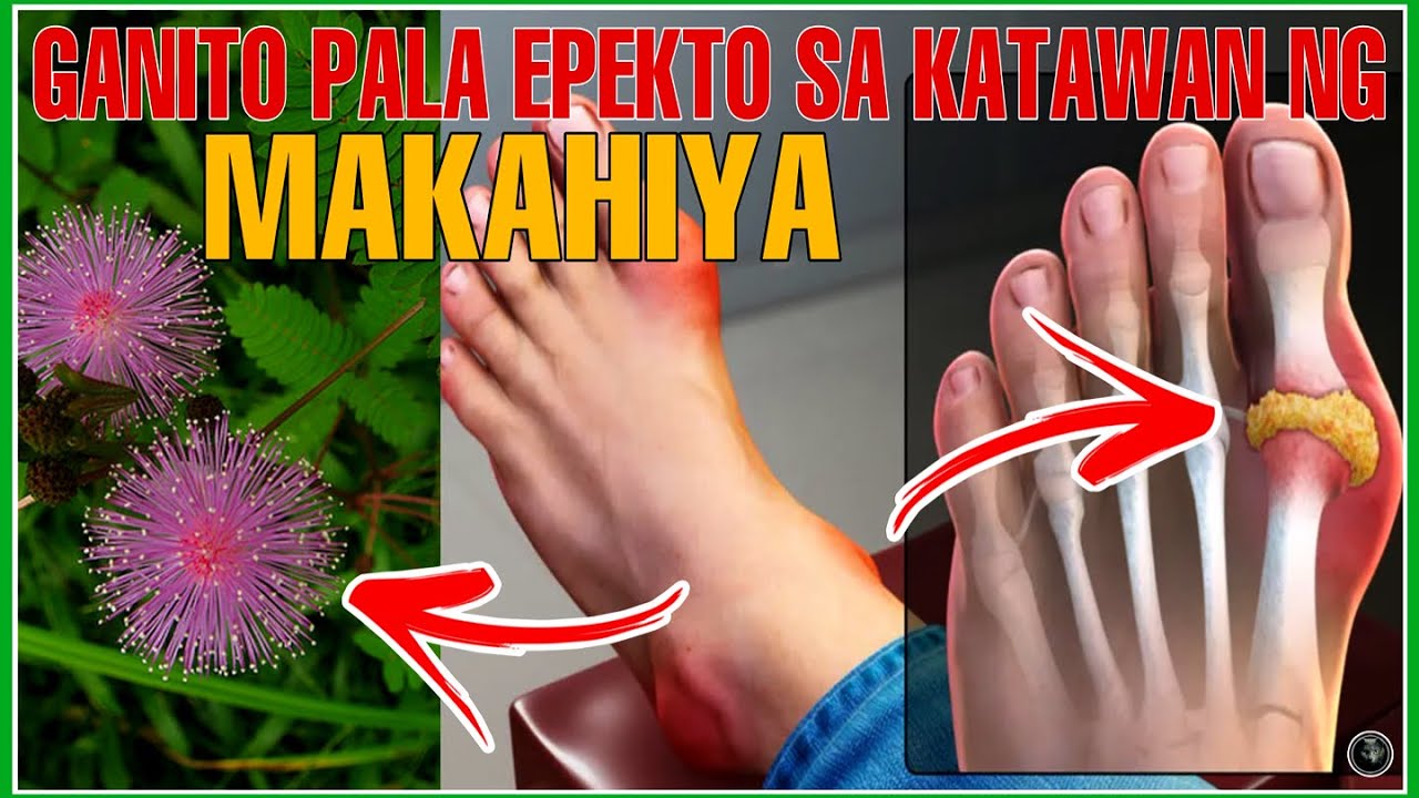 ANG HALAMANG UGAT NA MAKAKAALIS NG INYONG URIC ACID, BONE AT JOINT ...