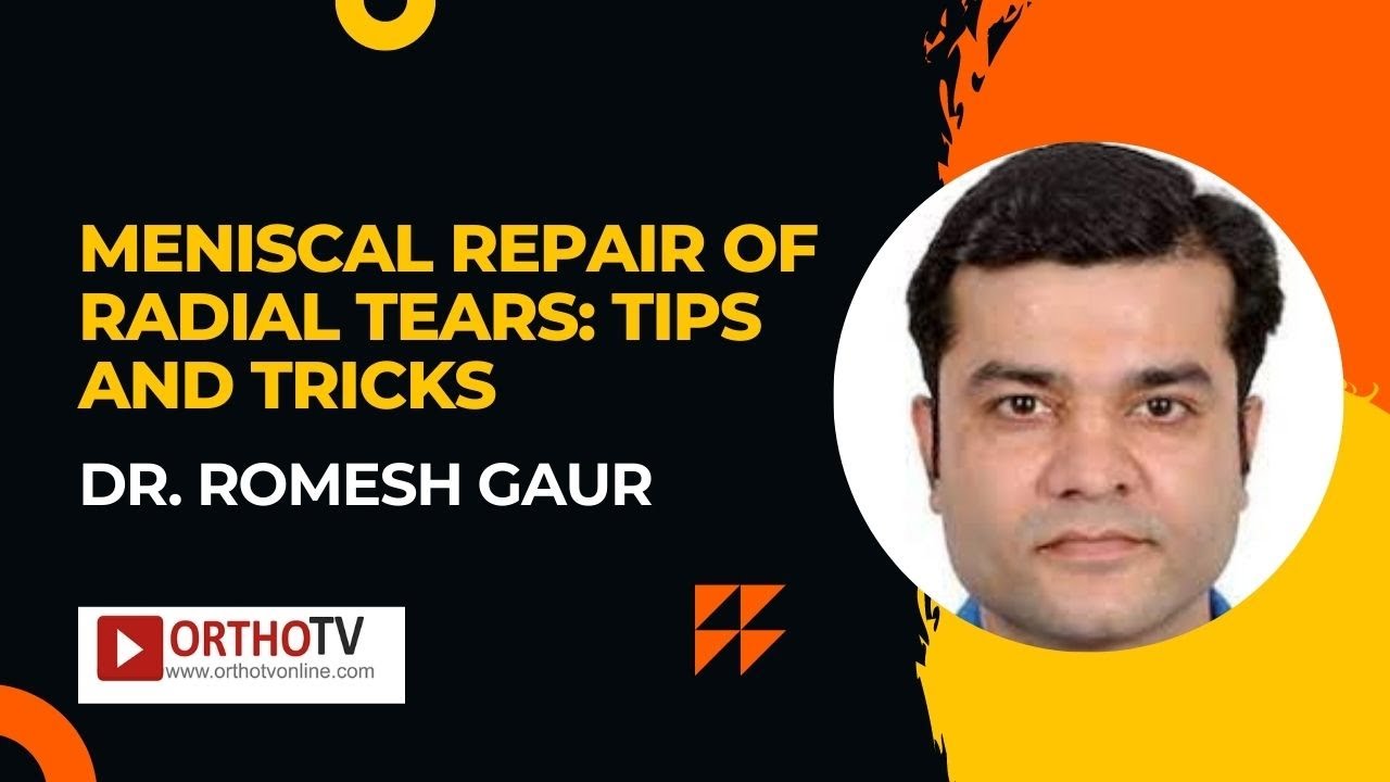 Meniscal repair of radial tears: Tips and tricks - Dr. Romesh Gaur ...