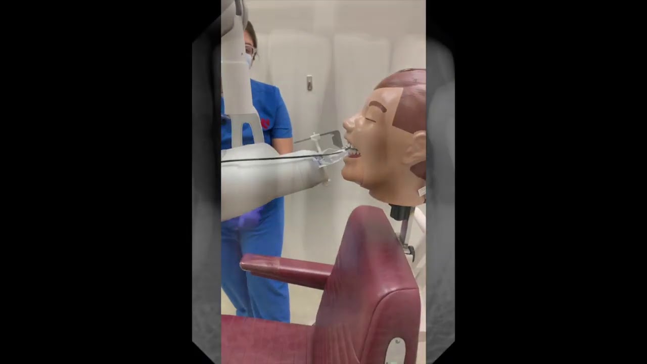 How to correct missing root apices - YouTube