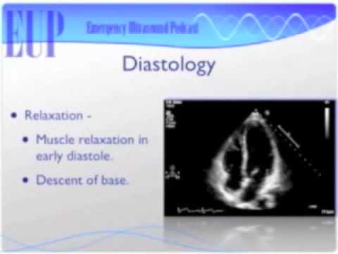 Ultrasound Podcast - DIASTOLOGY ULTRASOUND -- PART 1 - YouTube