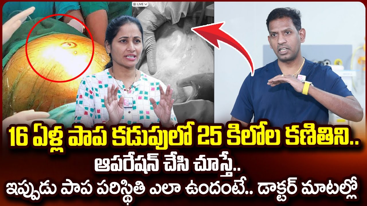 16ఏళ్ల పా_ప కడుపులో 25 కిలోల కణితిని.. |Dr. Chandra Sekhar Puli About ...