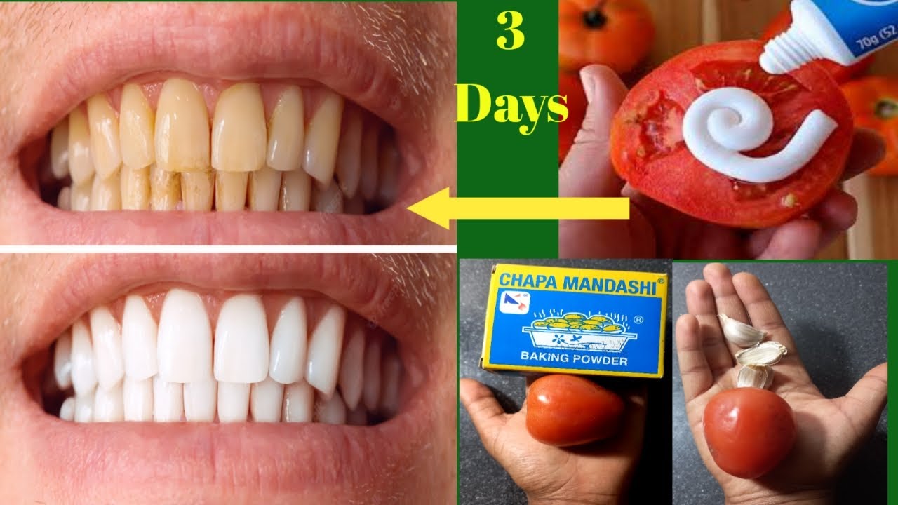 Teeth whitening at home in 3 days | How to whiten yellow teeth ...