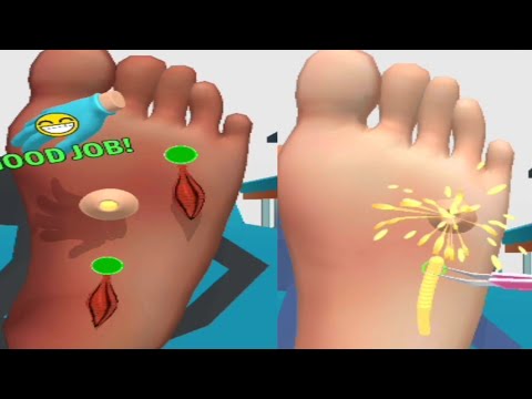 ASMR foot clinic surgery animation remove warts Android game #IMG - YouTube