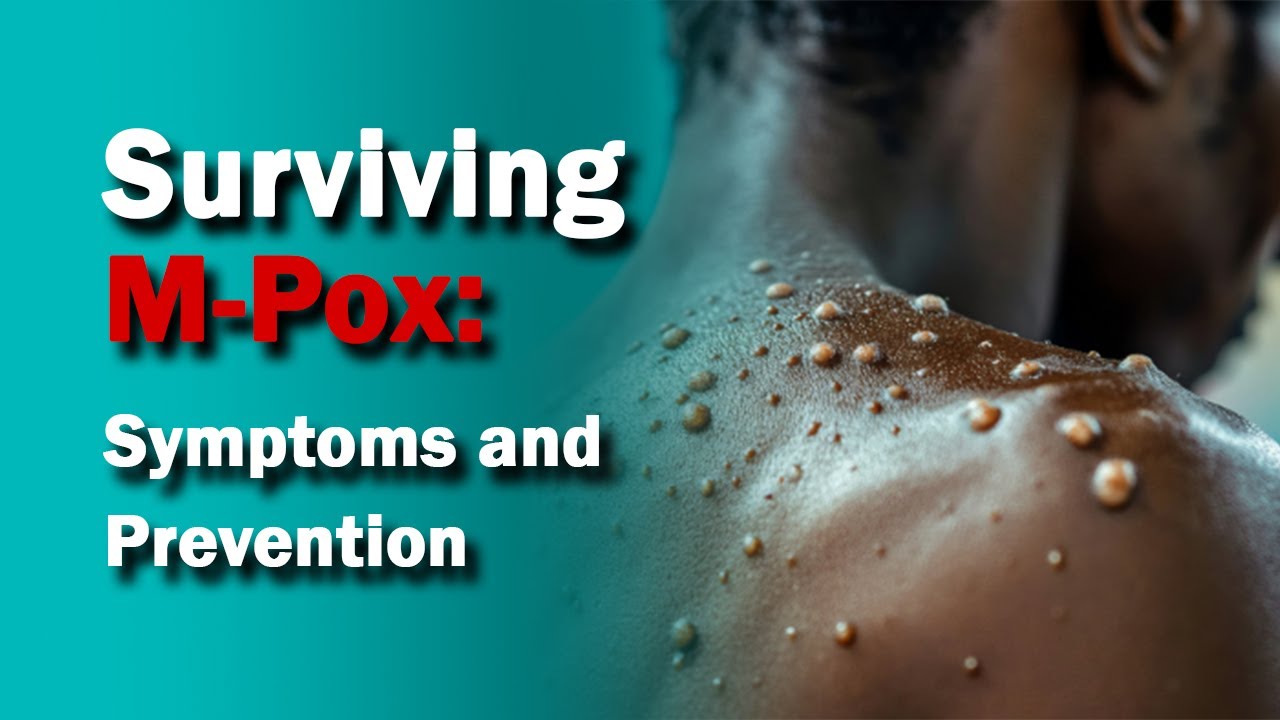 How to Survive the (probably) Upcoming M-POX Pandemic - YouTube