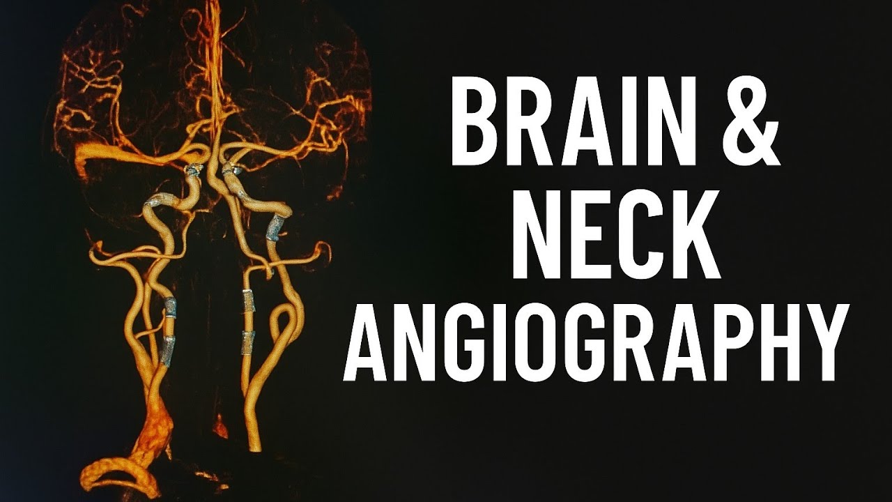 How to Perform Brain & Neck Angiography 🧠🫁 | Full Demo 🎬 - YouTube