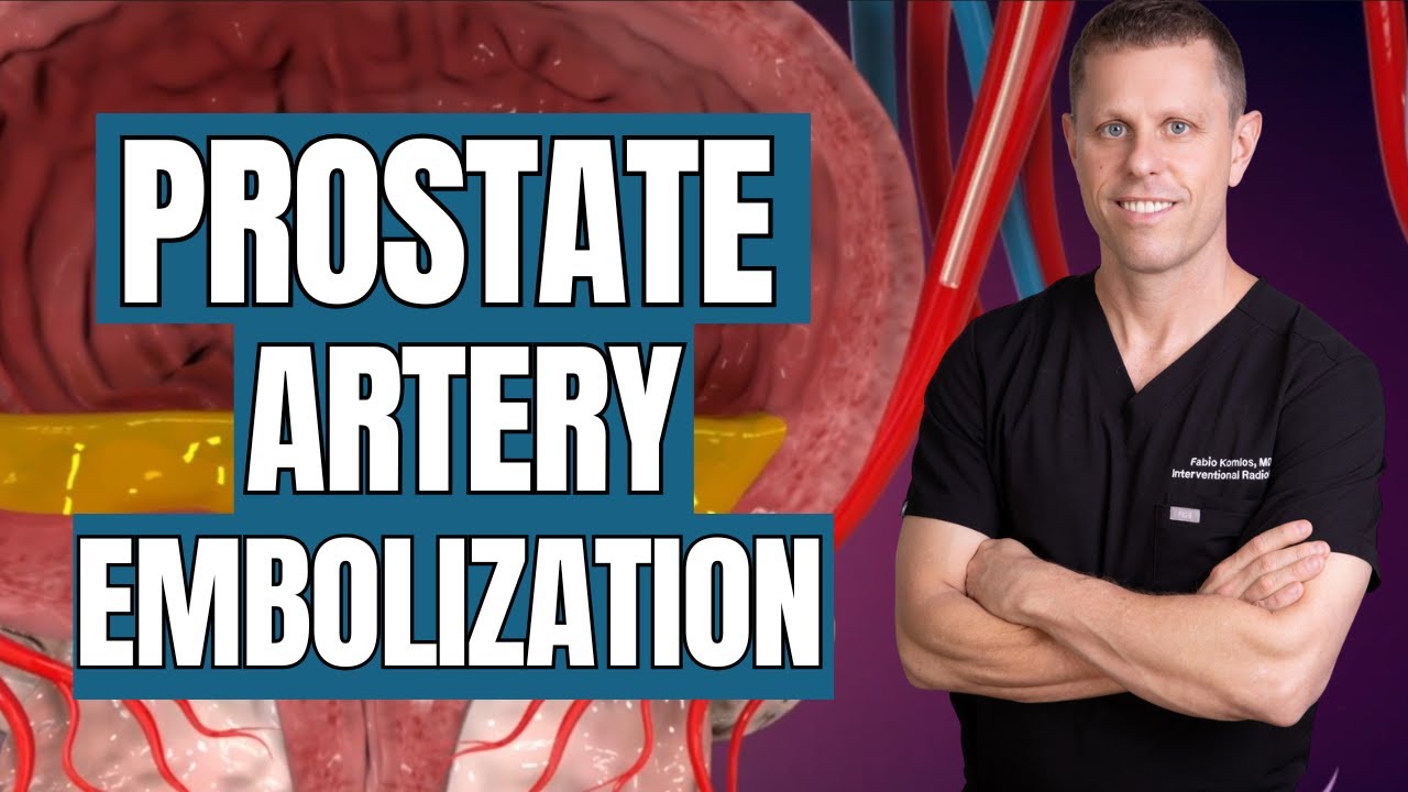 Prostate Artery Embolization - YouTube