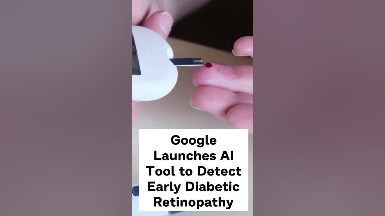 Google Launches AI Tool to Detect Early Diabetic Retinopathy #ai#google ...