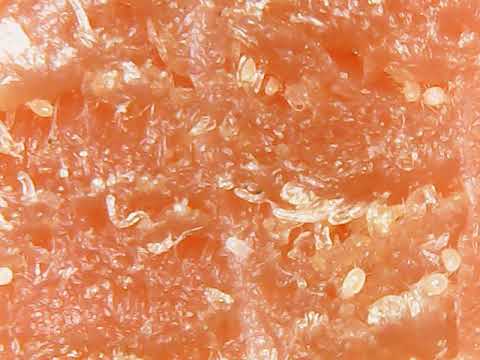 Ham Mites - YouTube
