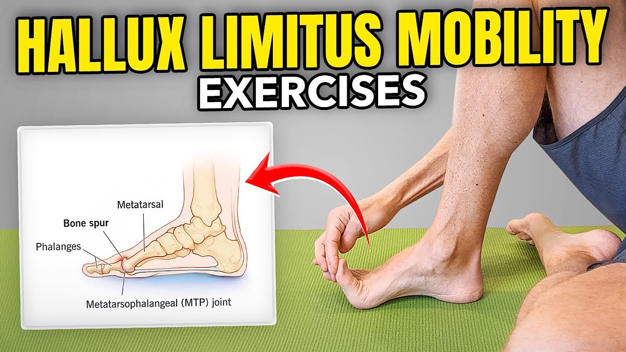 Big Toe Mobility Exercises (Hallux Limitus) - YouTube