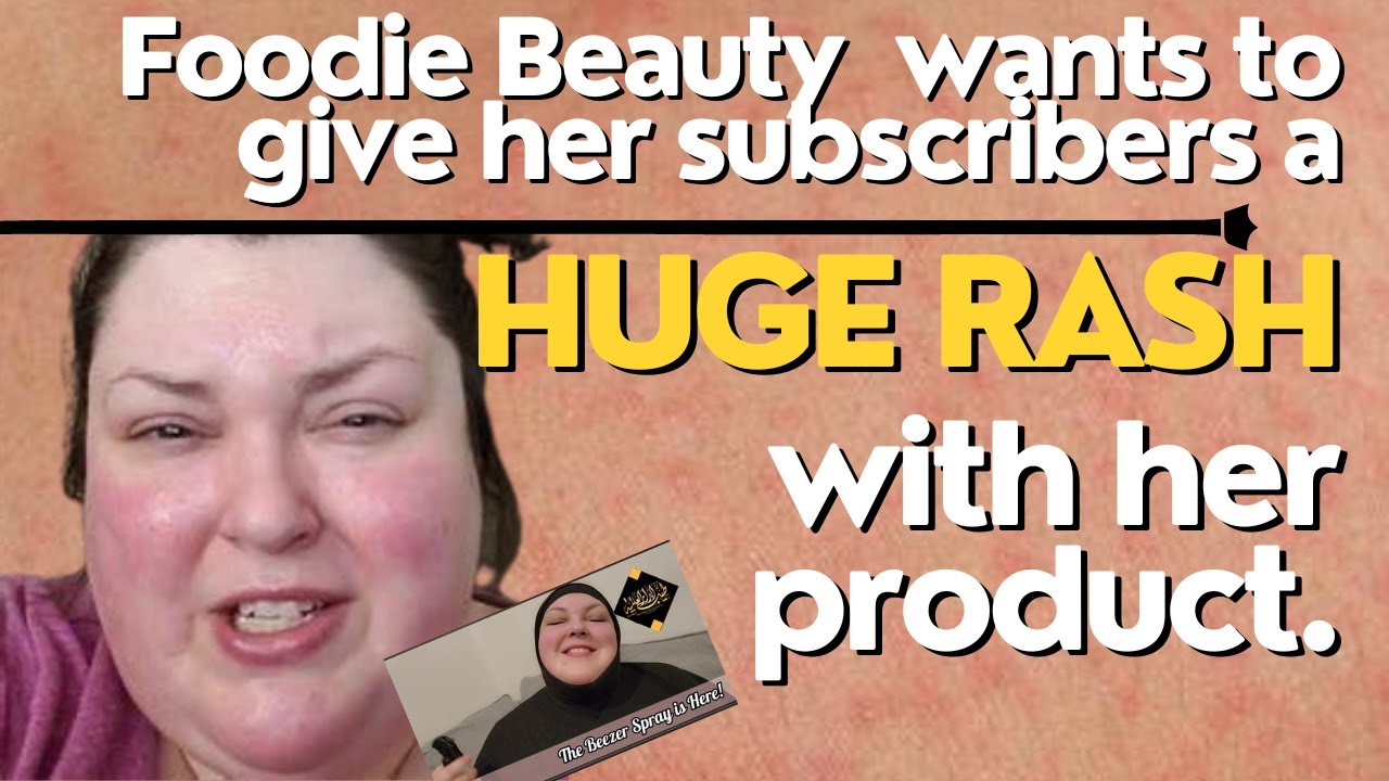 FOODIE BEAUTY WANTS TO GIVE YOU A PERFUME RASH! - YouTube