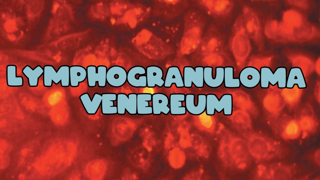 Lymphogranuloma venereum | chlamydia trachomatis - YouTube