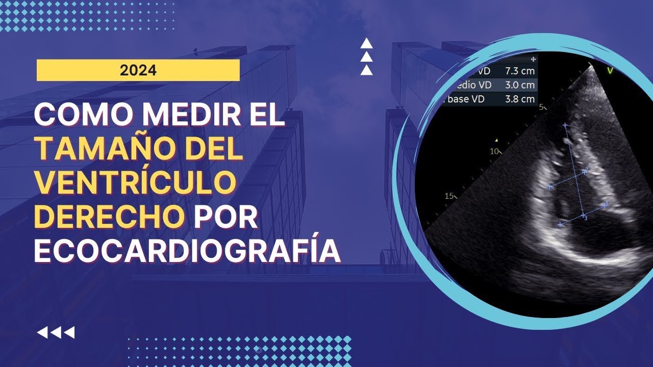 🚀[Cómo Medir] el 🔥TAMAÑO DEL VENTRÍCULO DERECHO por Ecocardiografía ...