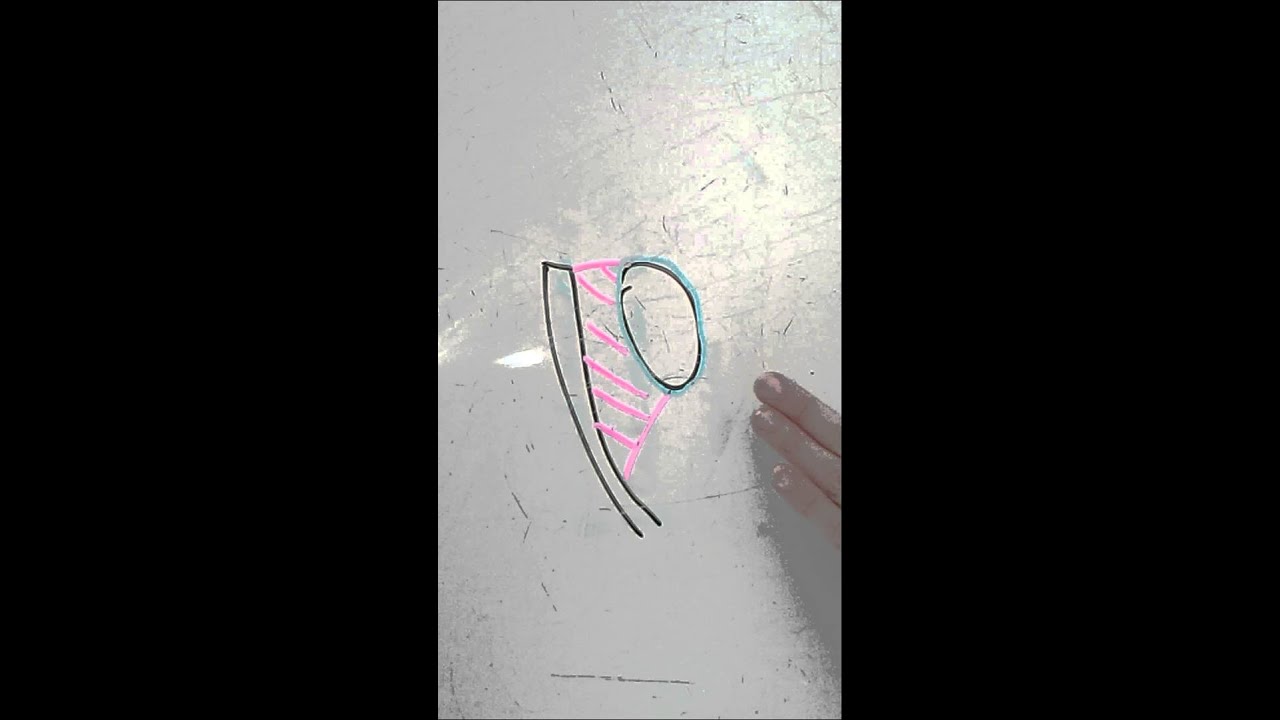 ¿QUE ES EL MESOSALPINS Y LA LINEA DE FARRE? - YouTube