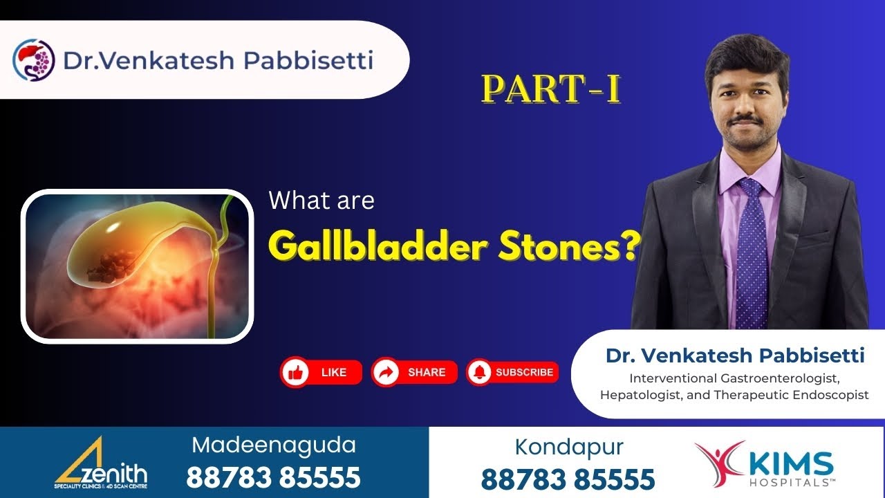 What Are Gallbladder Stones? A Comprehensive Overview. | Part- I ...