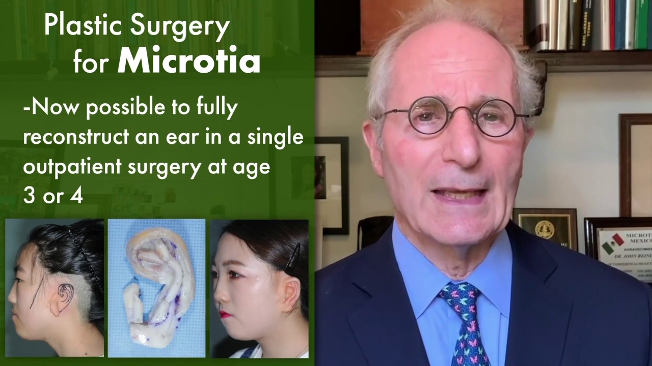 Microtia Reconstruction —Video Discussion by John F. Reinisch, MD - YouTube