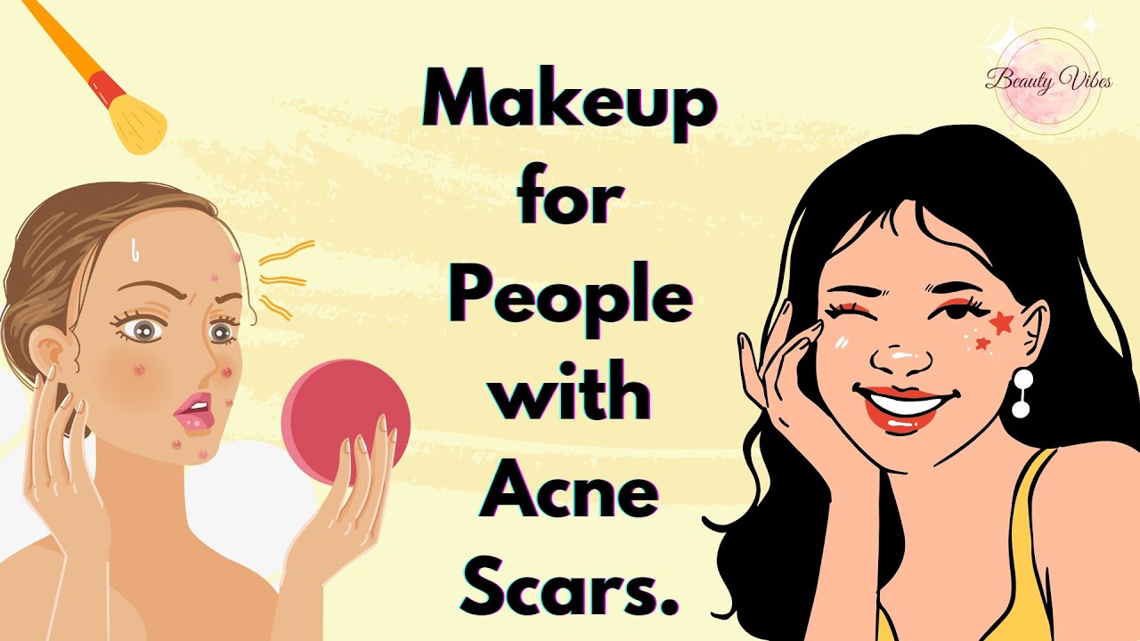 Flawless Beauty: Makeup Tips for People with Acne Scars #makeup # ...