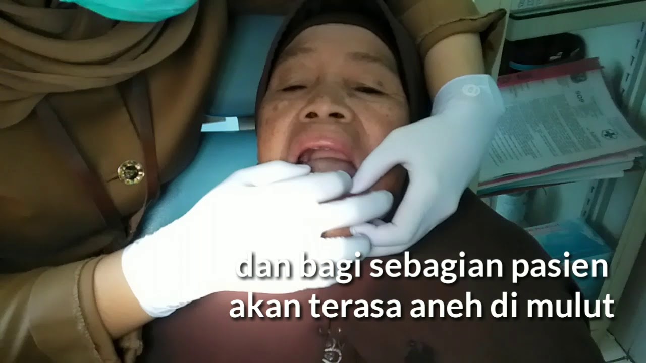 BEGINILAH PROSES PEMASANGAN GIGI PALSU VALPLAST TANPA KAWAT - YouTube