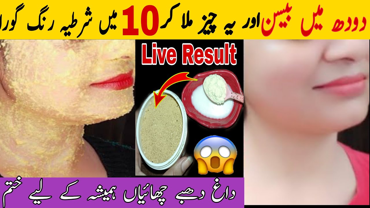 How to Whiten Skin Fast Naturally 😲| Remove Dark Spots & Pigmentation ...
