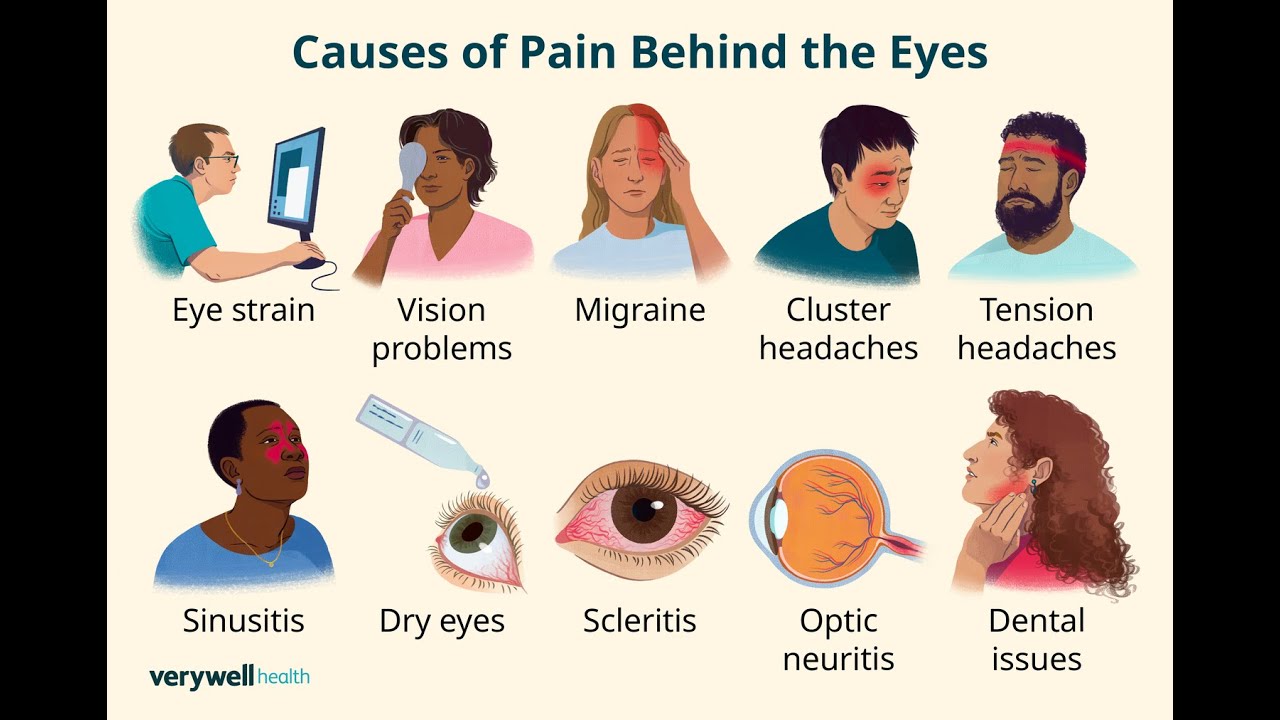 How to Stop Weak Eyesight - by using these TIPS - YouTube