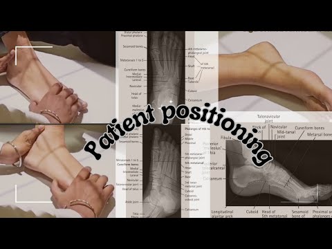 learn Foot x ray positioning|| centring?|| Basic terminology|| patient ...