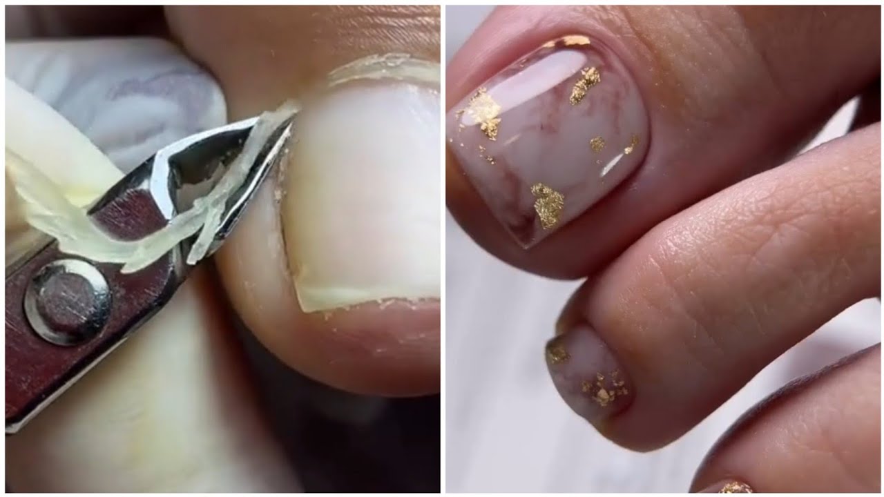 Most Satisfying Pedicure Transformation 2025 - YouTube