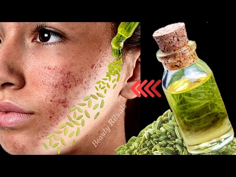 Cilt Beyazlatma Ev Çözümleri | Koyu Lekeleri ve Kırışıklıkları Gidermek İçin Ev Yapımı Yüz Maskesi